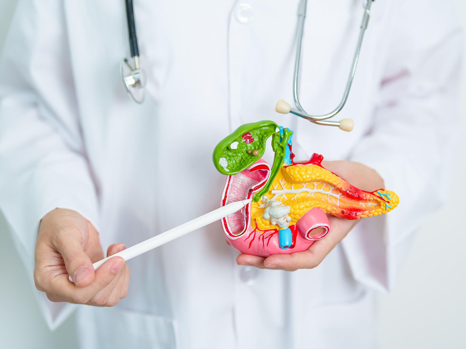 Comprehensive Gallstone Treatment | GastroDoxs